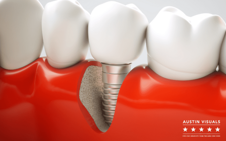 3D Dental Animation Video Production Company