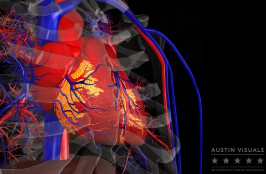3D Medical Animation | Medical Animation Production Company