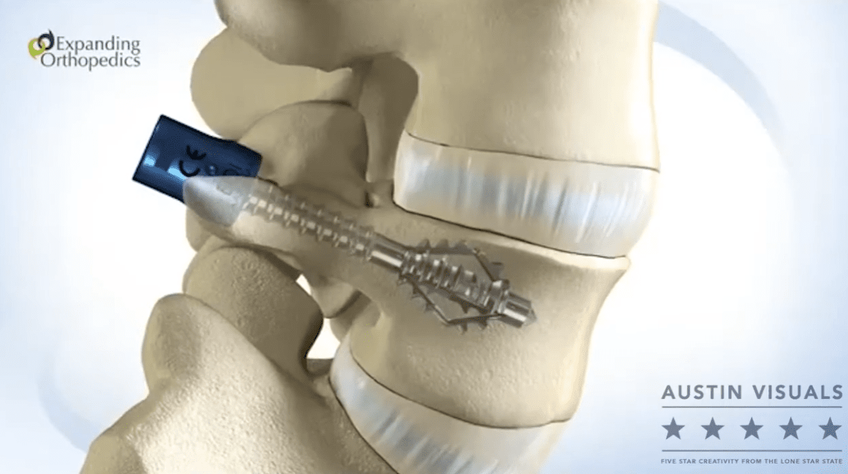 Medical 3D Modeling Costs And 5 Most Common Uses